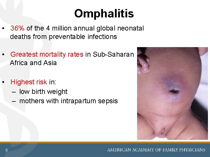 Why not teach mother Maternal Education in Chlorhexidine