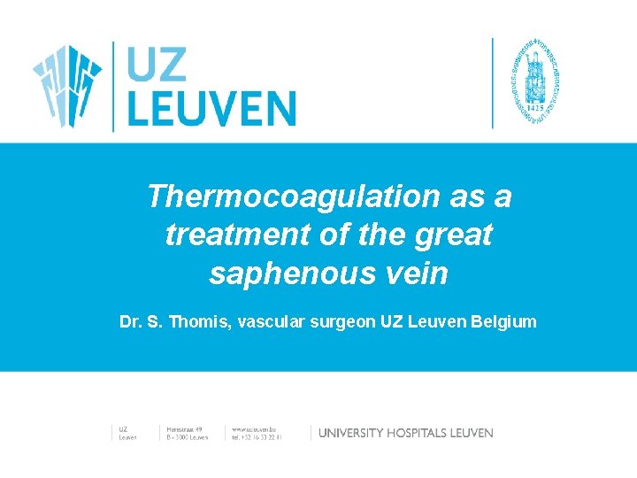 Thermocoagulation as a treatment of the great saphenous
