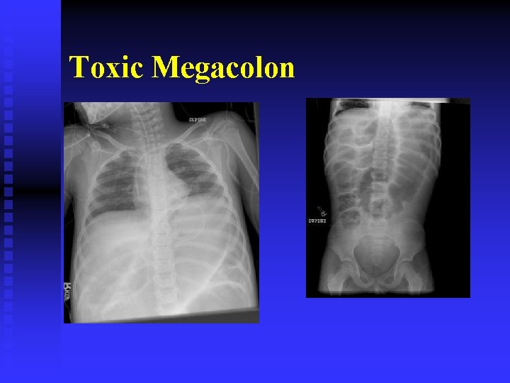 Pediatric Surgical Emergencies Dr Abdelbaset Ali Ahmed Assistant