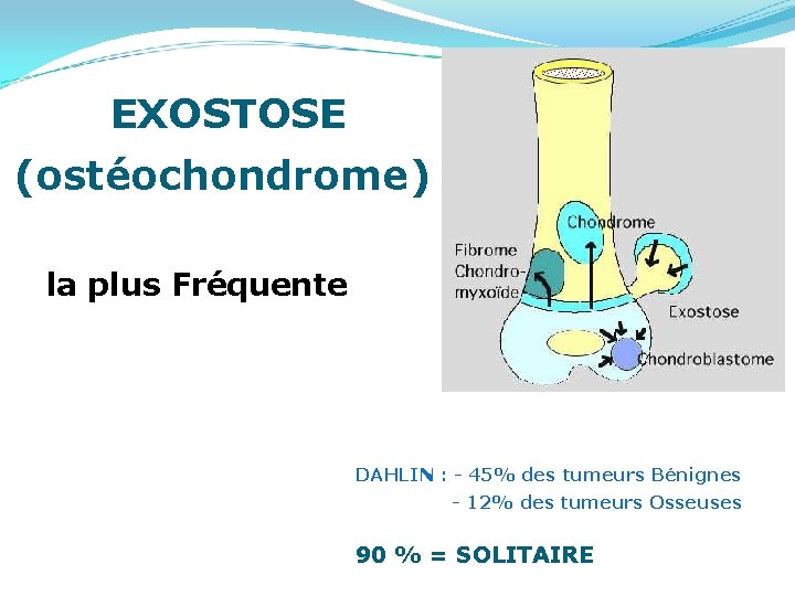 LES TUMEURS OSSEUSES PRIMITIVES DU CALCANEUM A Bouden