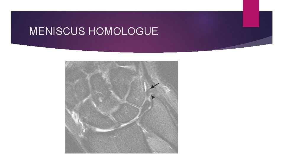 Imaging of Wrist DR AMITA HARSULE Basic Radiograph