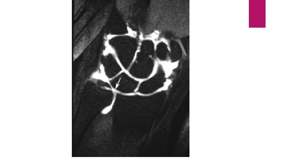 Imaging of Wrist DR AMITA HARSULE Basic Radiograph
