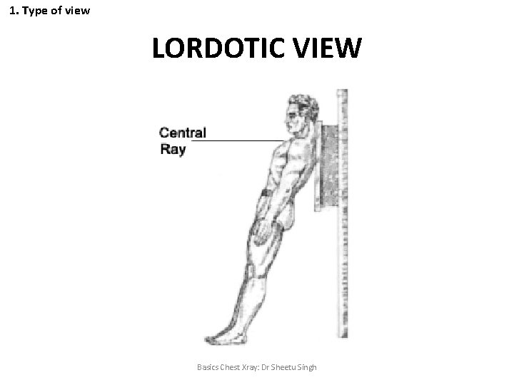Basics of chest X ray Dr Sheetu Singh
