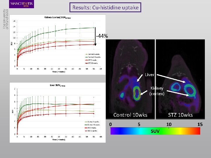Pilot study of 64 Cuhistidine 2 PET imaging