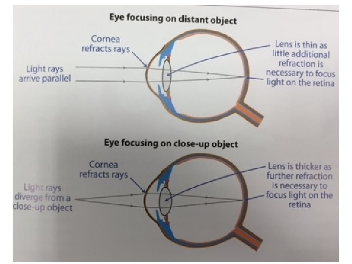 Anatomy of the Eye Match activity Part of
