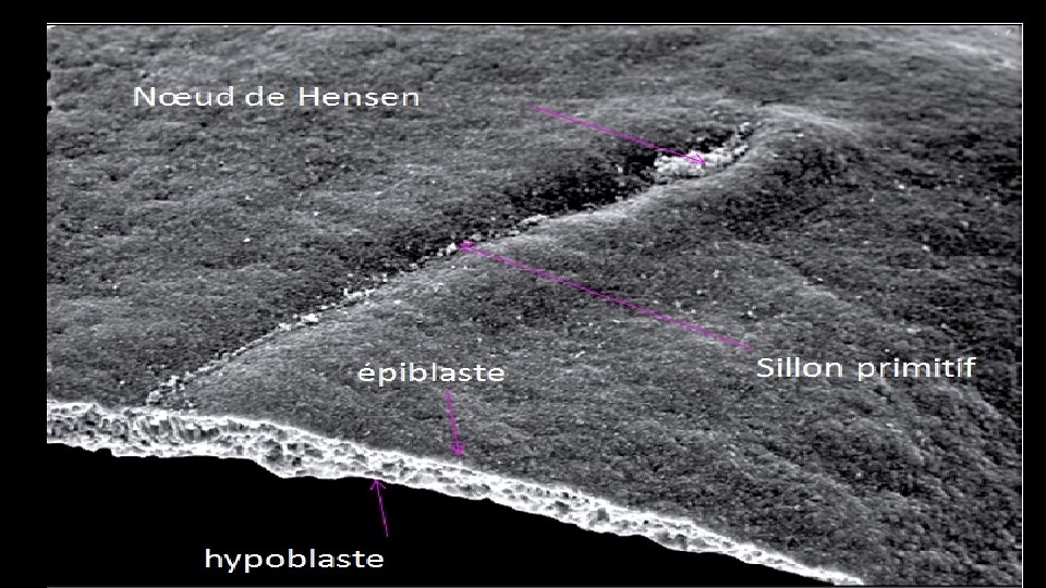 Troisime semaine du dveloppement embryonnaire Dr Mammeri Dr