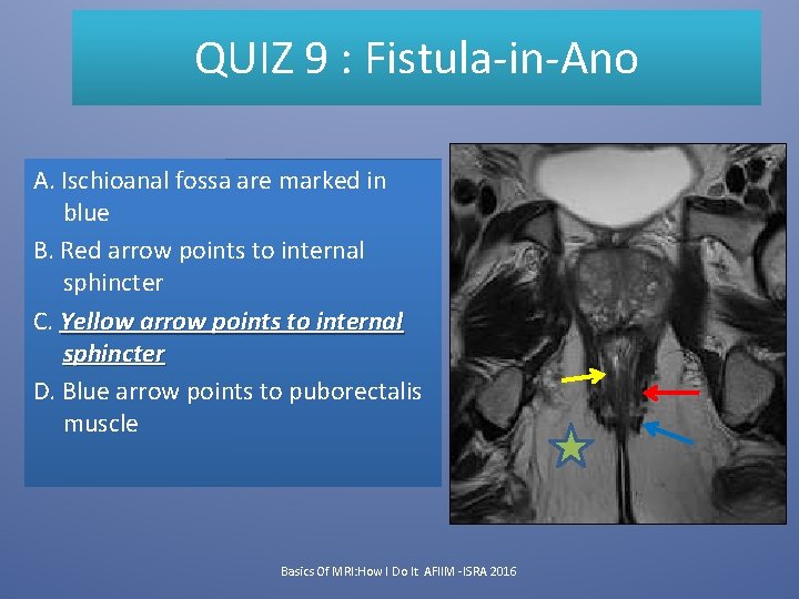 QUIZ 8 FistulainAno Basics Of MRI How I
