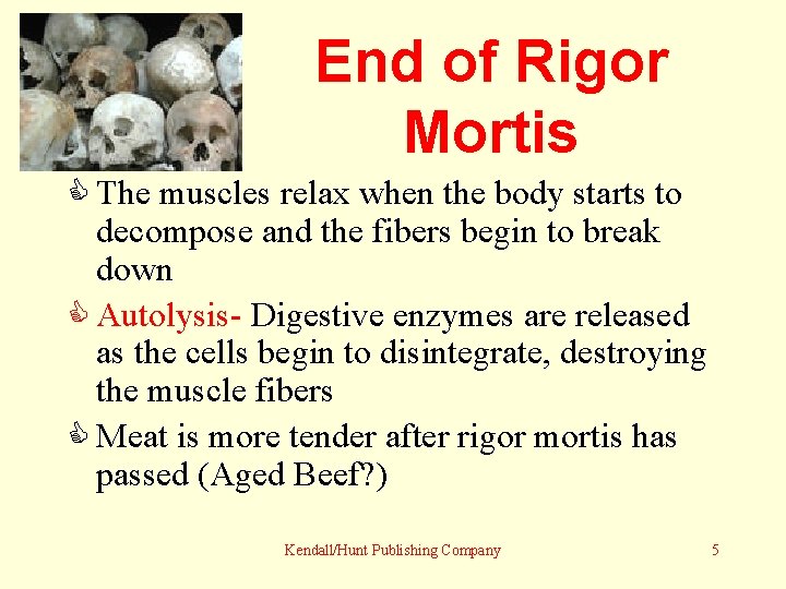 Chapter 12 Human Remains There is a brief