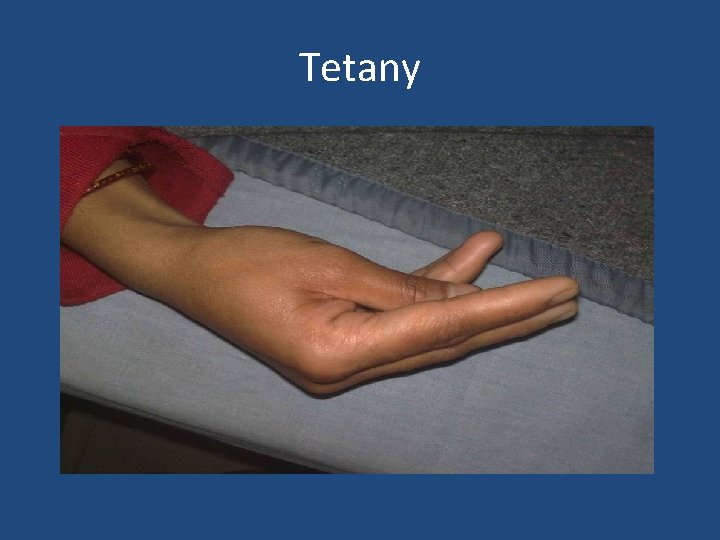 Calcium Metabolism Primary Hyperparathyroidism Calcium metabolism 99 of