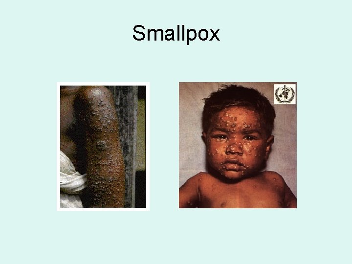 ANTIMICROBIAL DRUGS Epidemic History 14 th century Europe