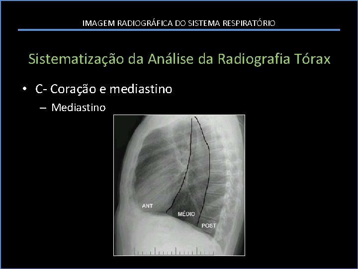 Semiologia Radiogrfica SISTEMA RESPIRATRIO Acd Elpidio Ribeiro 05112012