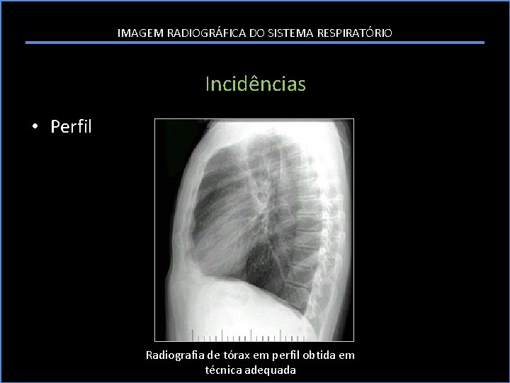 Semiologia Radiogrfica SISTEMA RESPIRATRIO Acd Elpidio Ribeiro 05112012