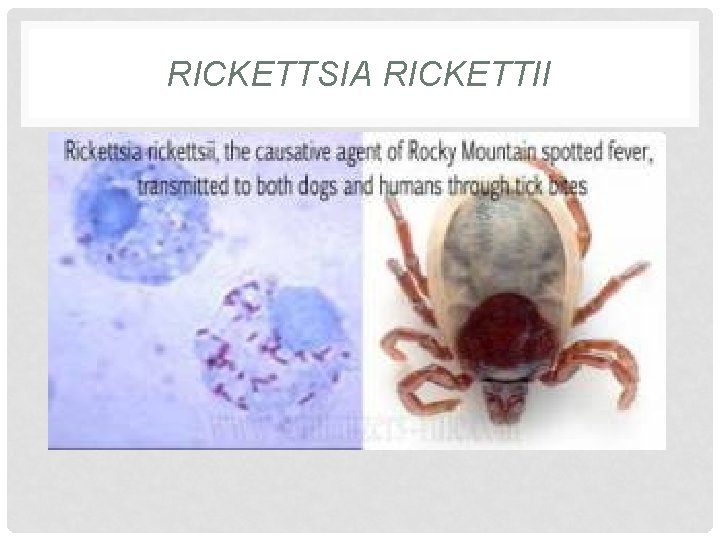 BACTERIAL DISEASES RICKETTSIAS Coccus or bacillus Intracellular parasite