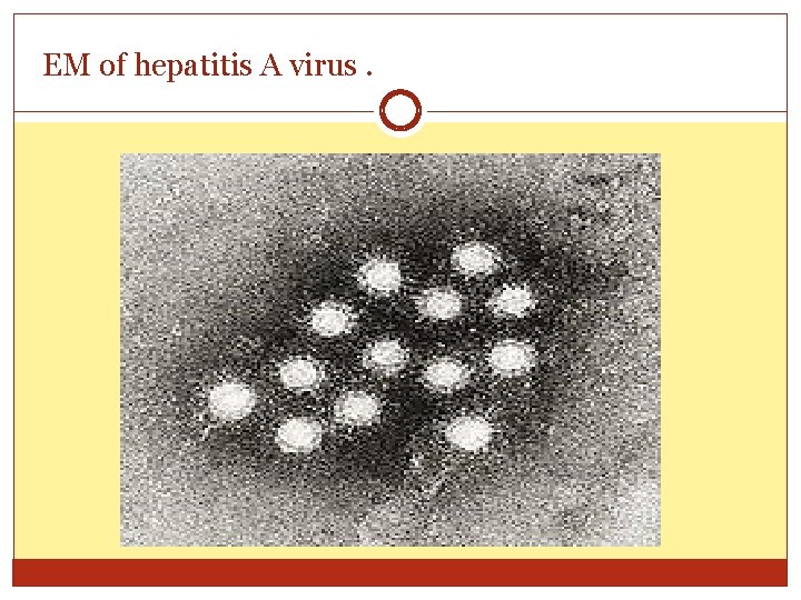 Enterically transmitted hepatitis Waterborne hepatitis DR MOHAMMED ARIF