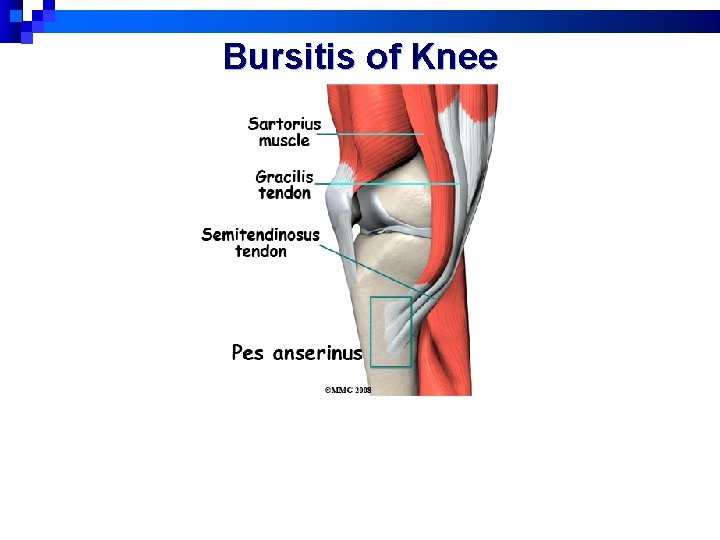 Set 10 Muscles Hip and Hamstrings Hamstring Muscle