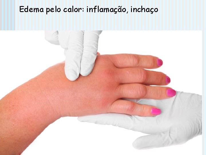 HIGIENE OCUPACIONAL AGENTE FSICOS QUMICOS E BIOLGICOS AGENTES
