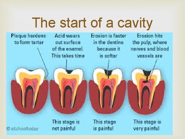 Protecting Teeth Skin Prompt 12815 Tell me about