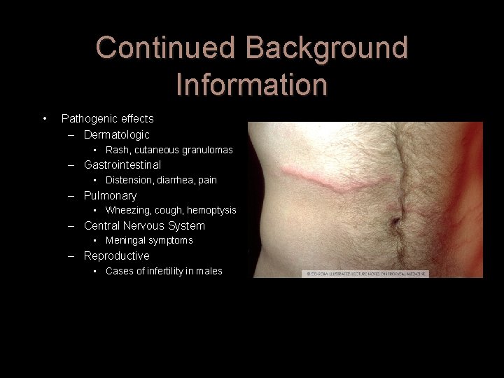 Strongyloides stercoralis Peter Bertrn Background Information Nematode 2