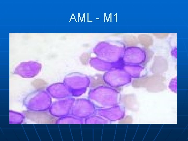 Leukemia and Lymphoma Dental Views By Fatin Al