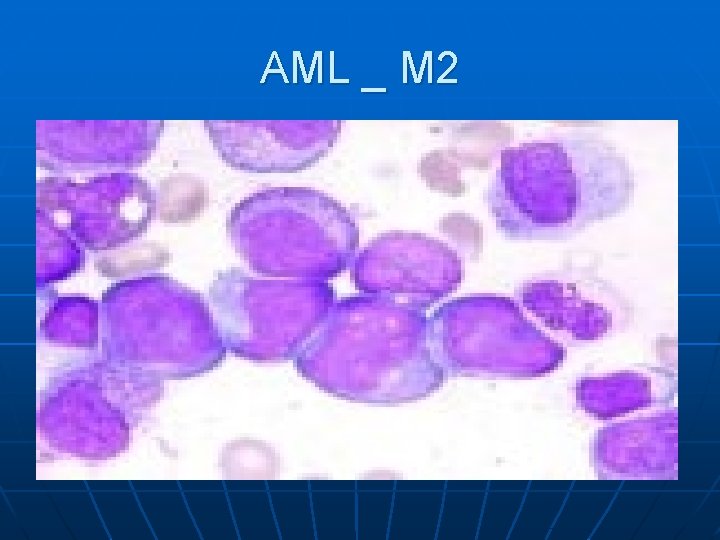 Leukemia and Lymphoma Dental Views By Fatin Al