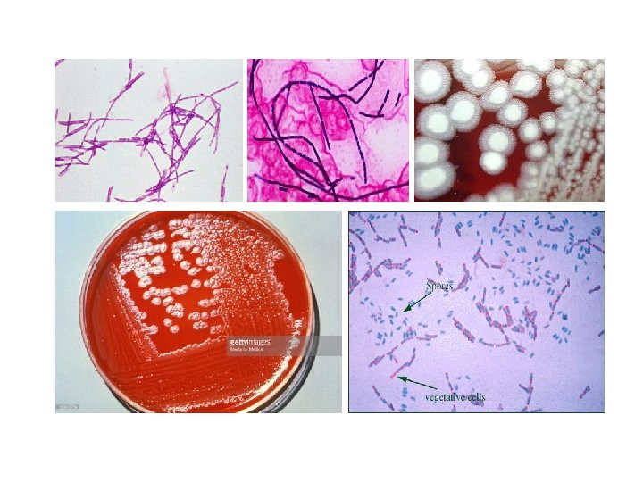 Bacillaceae Family Infections and Laboratory Diagnosis Bacillaceae family