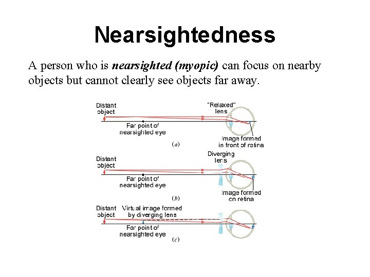 26 10 The Human Eye Anatomy The eyeball
