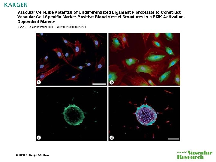Vascular CellLike Potential of Undifferentiated Ligament Fibroblasts to