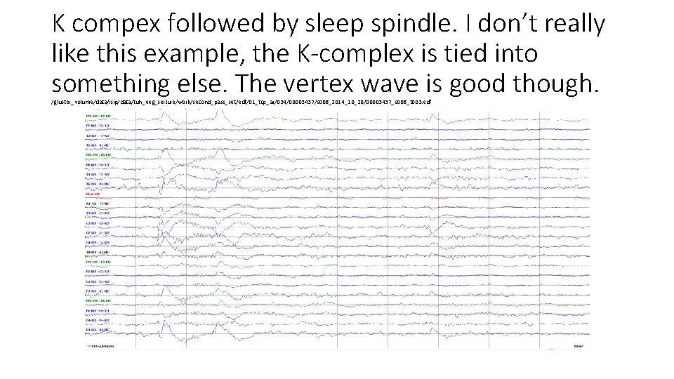 Annotations Guidelines Images Glossary for all the different
