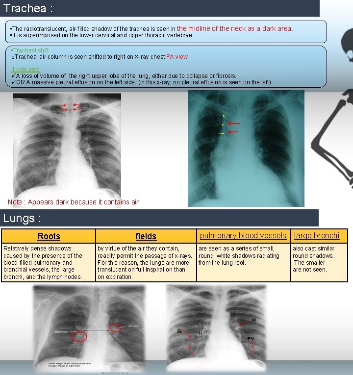 Radiological Anatomy Of The Chest By the end