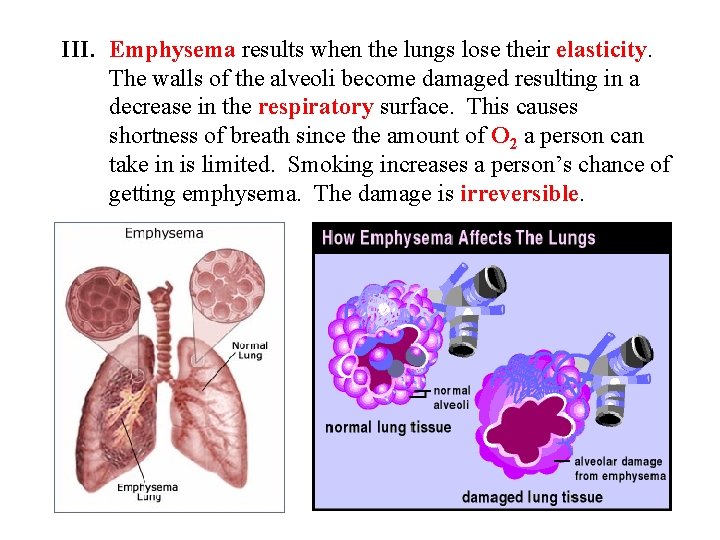Mechanics of Breathing I Lungs are very elastic