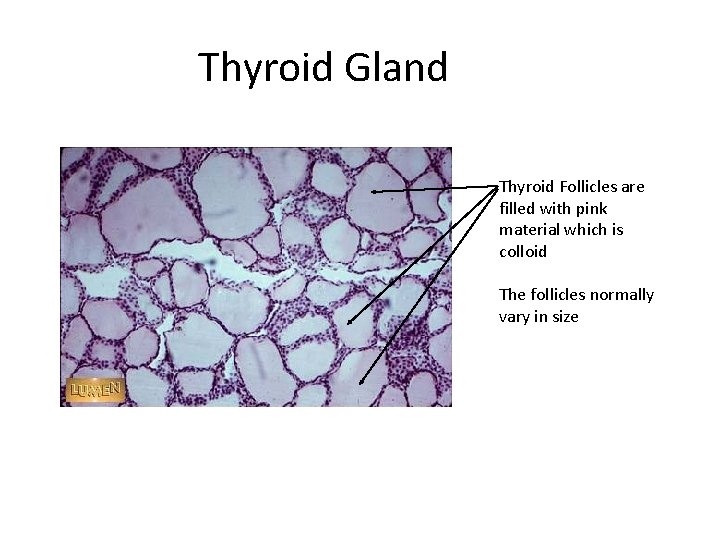 Histology for Pathology Endocrine Organs Objectives Pitutary Gland