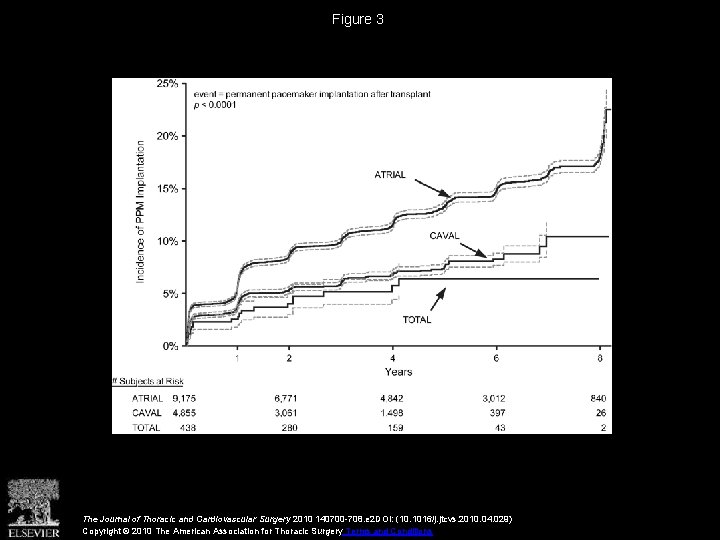 Standard versus bicaval techniques for orthotopic heart transplantation