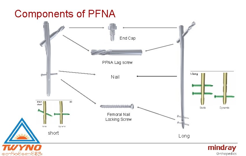 PFNAProximal Femoral Nail Antirotation Anatomy of Proximal Femur