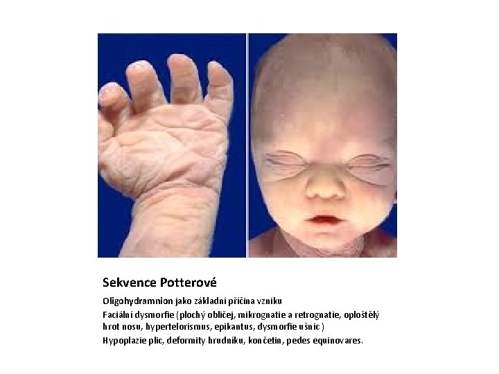 Patologie ledvin Histologick stavba ledviny Glomeruly Tubuly Intersticium