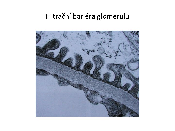 Patologie ledvin Histologick stavba ledviny Glomeruly Tubuly Intersticium