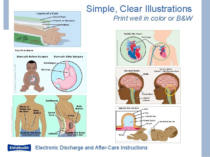 Discharge and AfterCare Instructions exclusively for pediatrics Kids