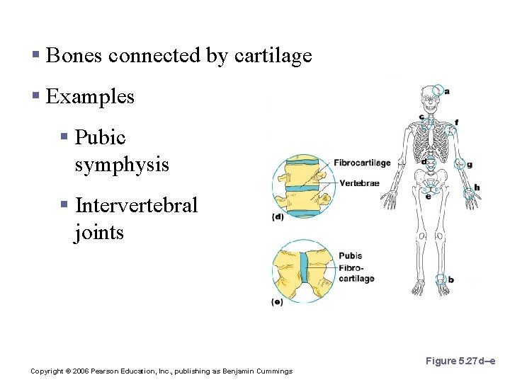 5 The Skeletal System PART F Power Point
