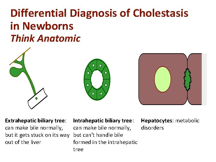 Pediatric Cholestatic Jaundice Differential Diagnosis of Treatable ...