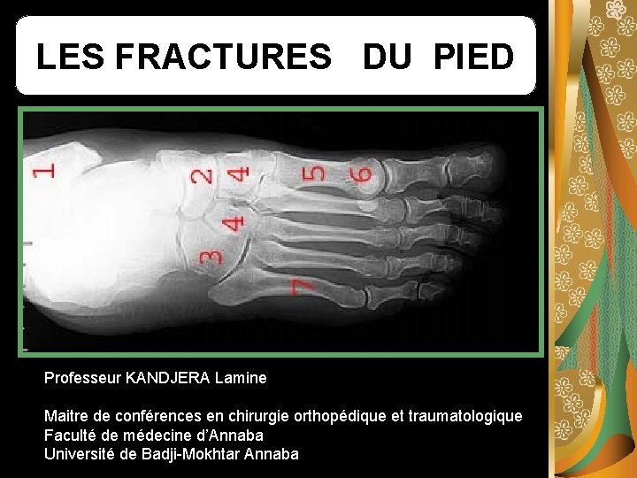 LES FRACTURES DU PIED Professeur KANDJERA Lamine Maitre
