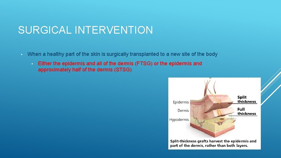 FULL THICKNESS SPLIT THICKNESS SKIN GRAFT Anatomy Pg