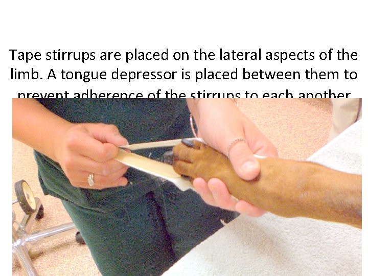 Bandage Types Robert Jones Bandage Used for temporary