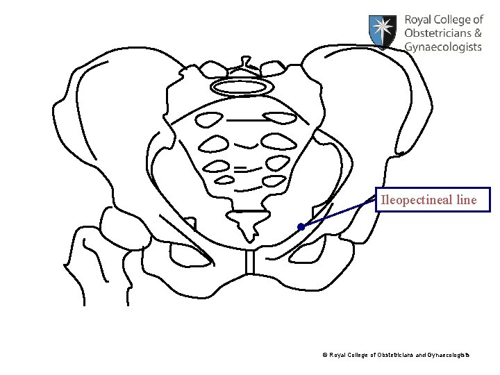 Anatomy of the female pelvis and vaginal birth