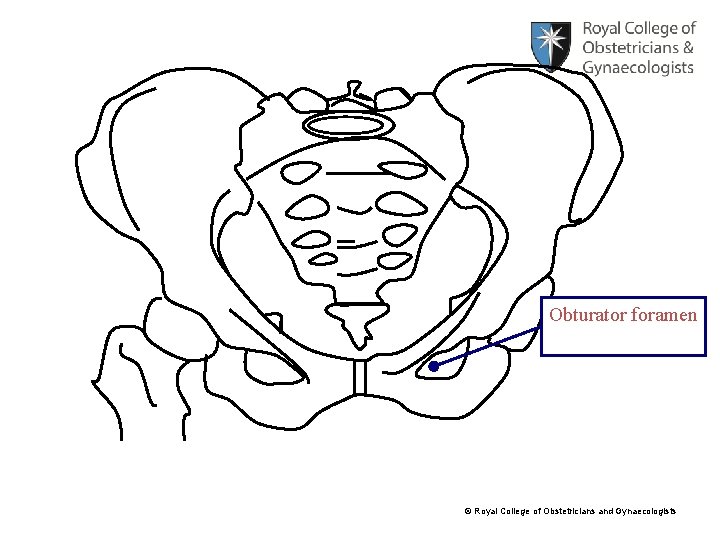Anatomy of the female pelvis and vaginal birth