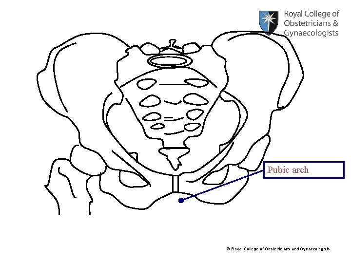 Anatomy of the female pelvis and vaginal birth