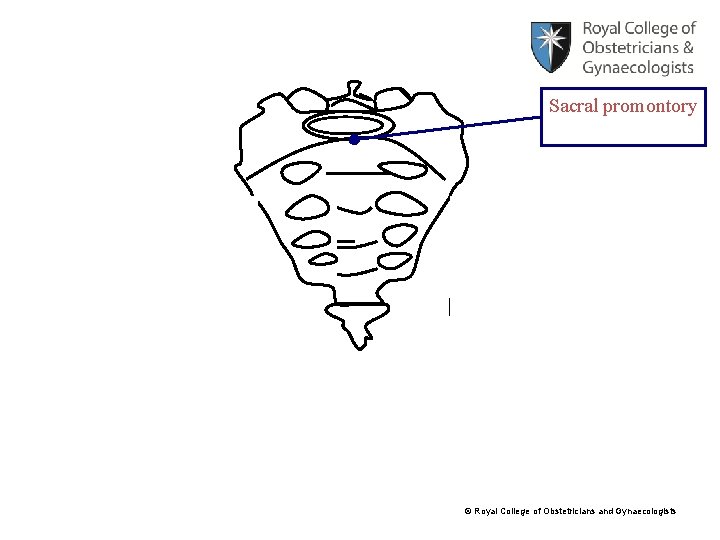 Anatomy of the female pelvis and vaginal birth