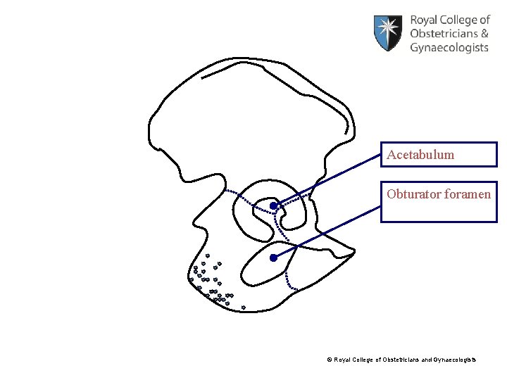 Anatomy of the female pelvis and vaginal birth