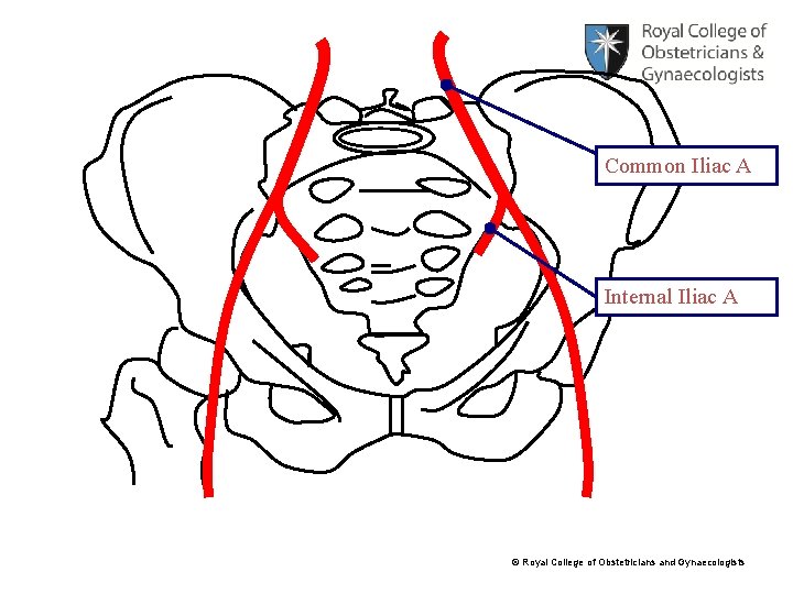 Anatomy of the female pelvis and vaginal birth