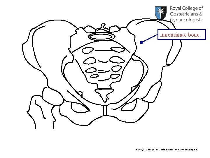 Anatomy of the female pelvis and vaginal birth