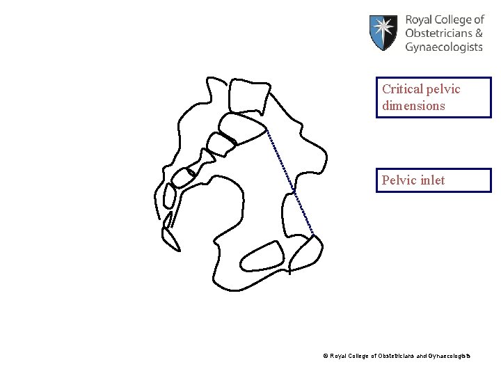 Anatomy of the female pelvis and vaginal birth