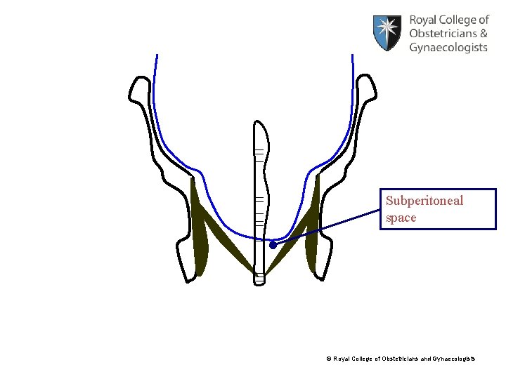 Anatomy of the female pelvis and vaginal birth